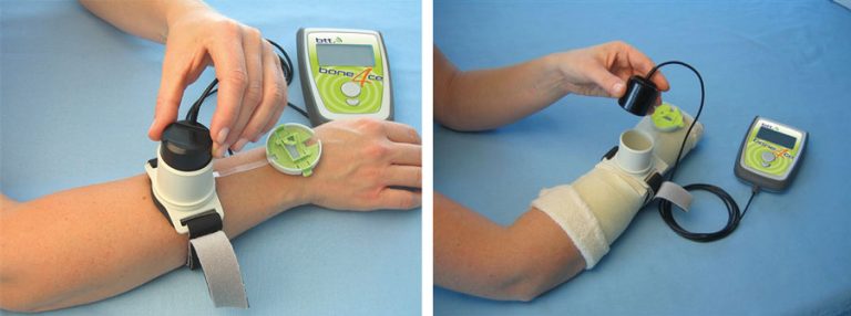 Application – bone4ce